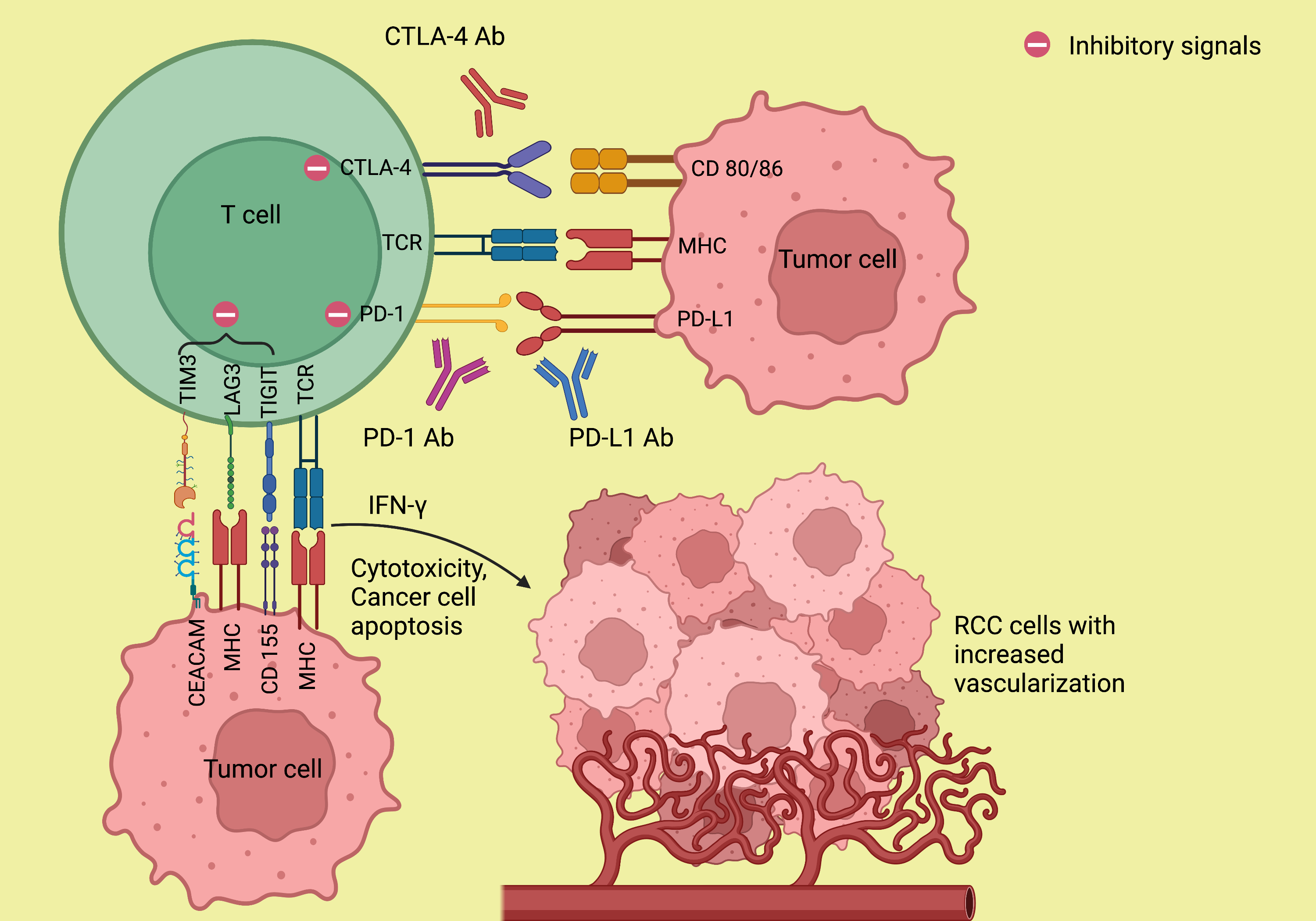 Emerging resistance vs. losing response to immune check point inhibitors in renal cell carcinoma ...