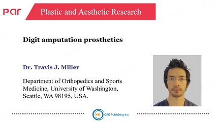 Digit amputation prosthetics