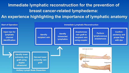 Immediate lymphatic reconstruction for the prevention of breast cancer ...
